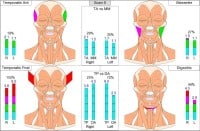 K7x Evaluation System - Myotronics