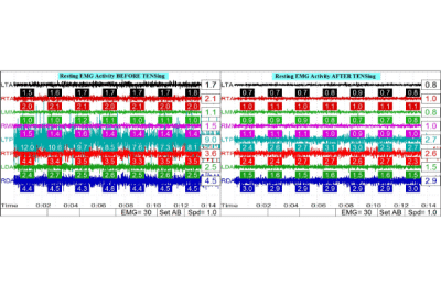 K7x Evaluation System - Myotronics