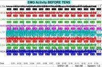 K7x Evaluation System - Myotronics