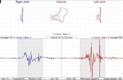 K7x Evaluation System - Myotronics